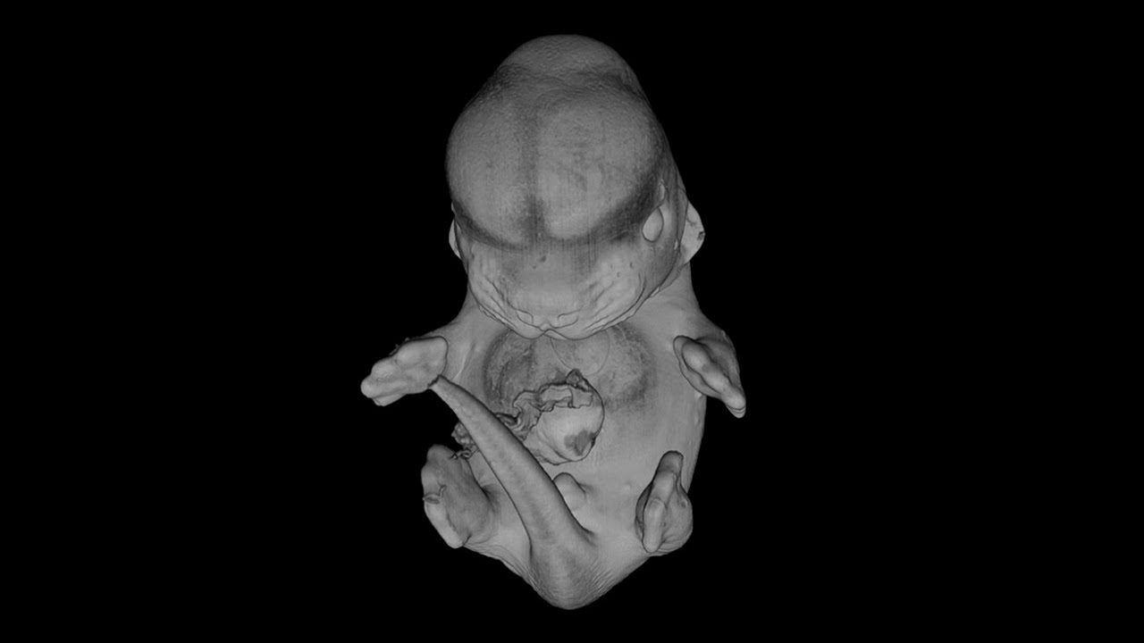 Brd2 mutant mouse embryo - YouTube
