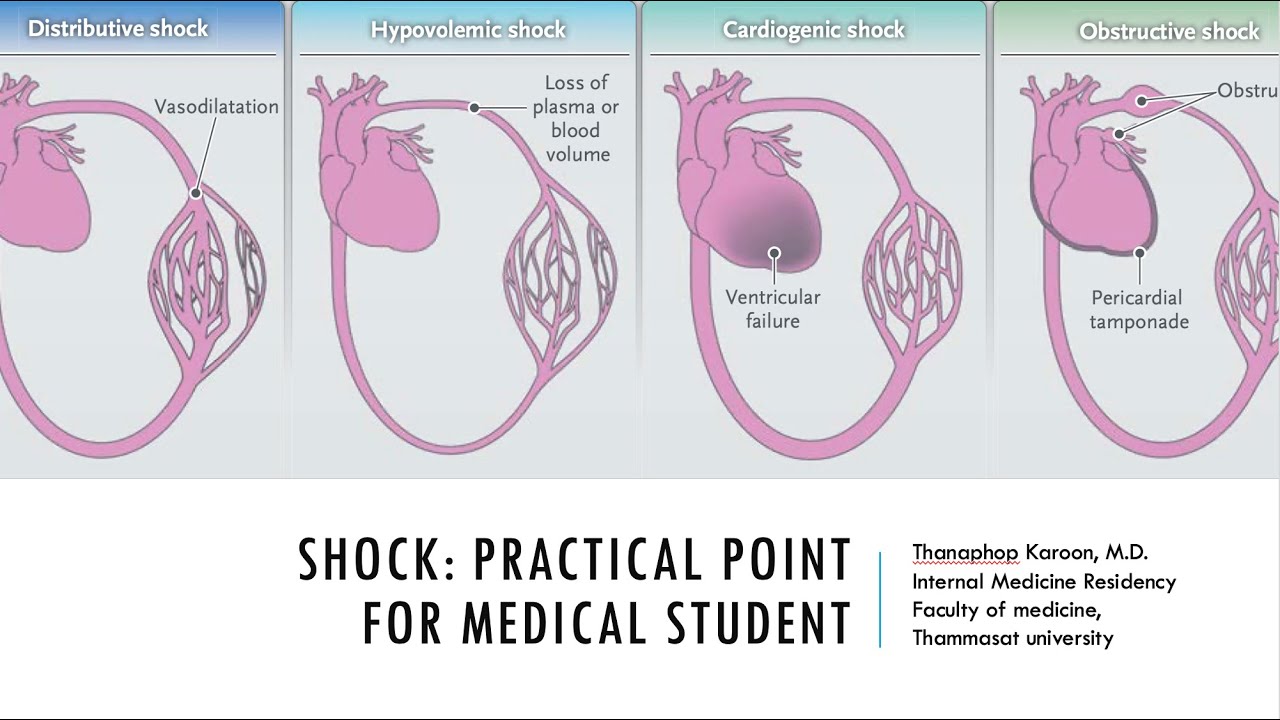 Shock: Practical point for medical student - YouTube
