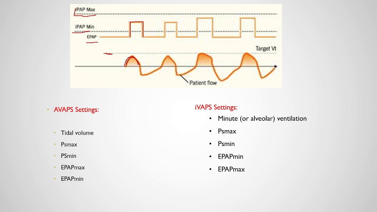 VAPS Volume assured pressure support - YouTube