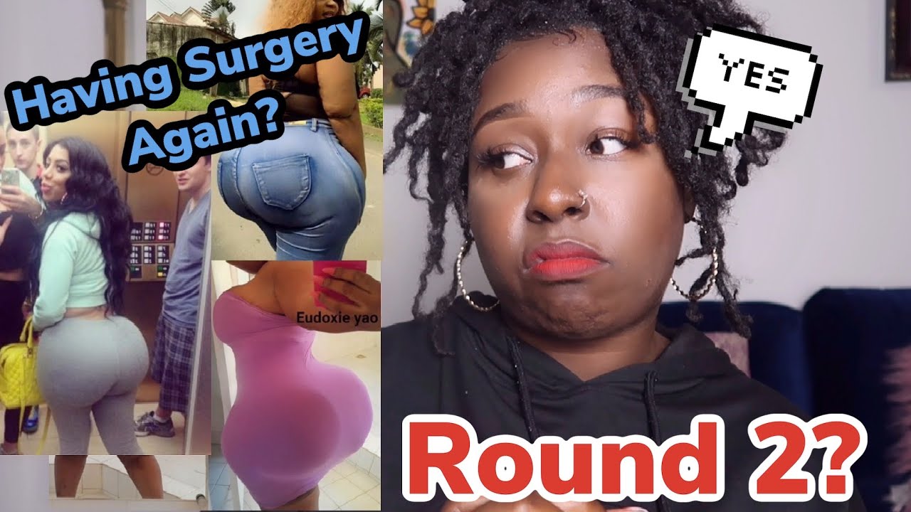 Why Is My Stomach Still Big? | 6 Month BBL Update | *WATCH UNTIL THE ...