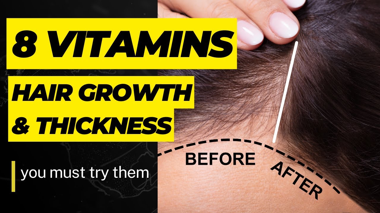 8 Best Vitamins For Instant Hair Growth And Thickness - YouTube