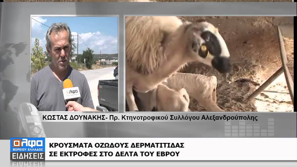 ΟΖΩΔΗΣ ΔΕΡΜΑΤΙΤΙΔΑ: ΘΕΤΙΚΟ ΚΑΙ ΤΟ ΔΕΥΤΕΡΟ ΔΕΙΓΜΑ - YouTube