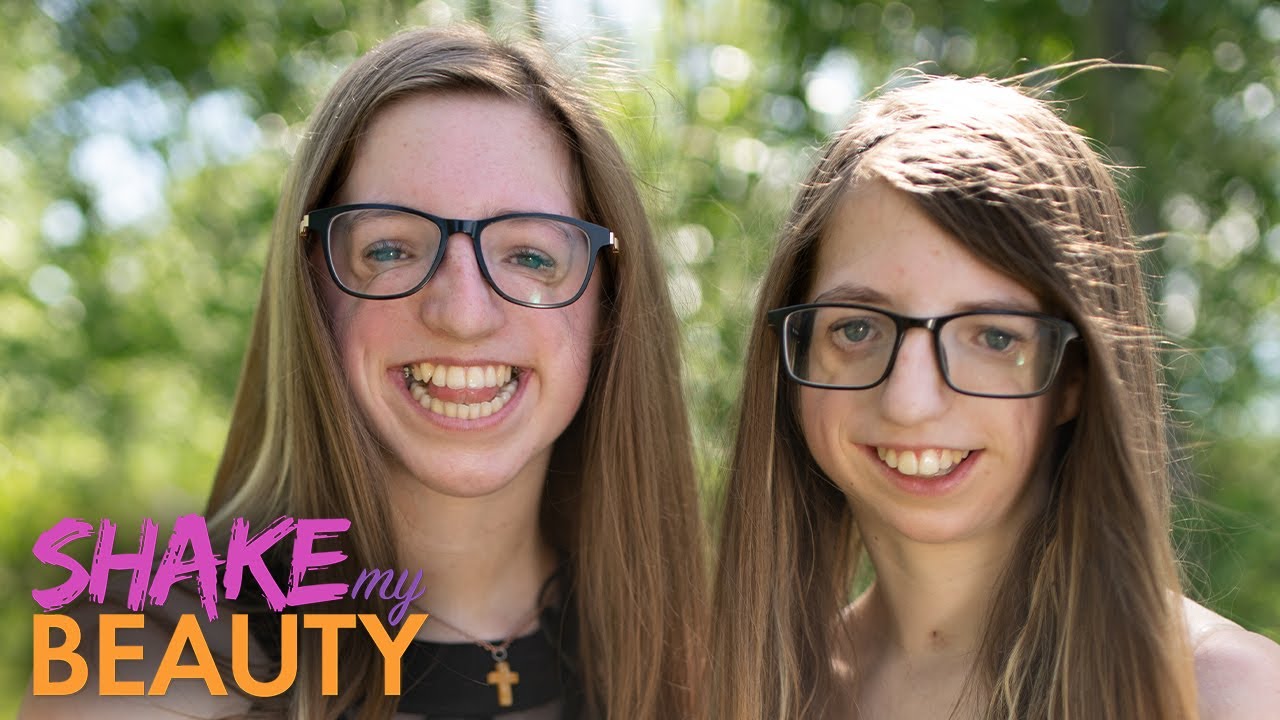 Identical Twins Refuse Cosmetic Surgery On Facial Differences Shake