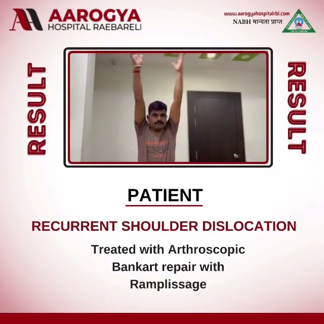 RECURRENT SHOULDER DISLOCATION - Treated with ArthroscopicBankart ...