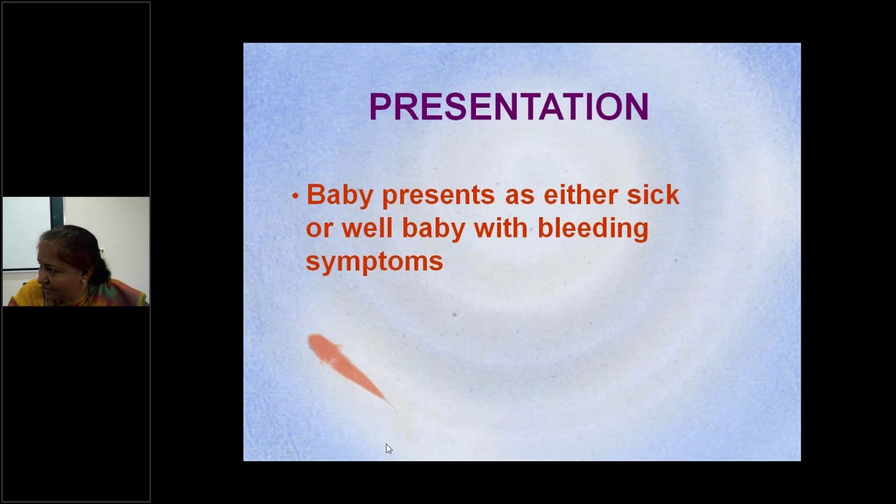 A Class On Bleeding Neonate By Dr Vasundara,Dept Of Paediatrics - YouTube