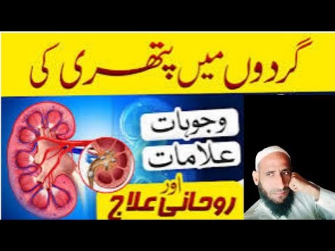 Gurday ya Pitta ma Pathri Raza Raza ho#amliyat sa Rohni ilaz Gurday ki ...