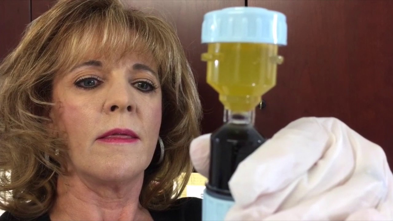 How to prepare Platelet Rich Plasma - YouTube