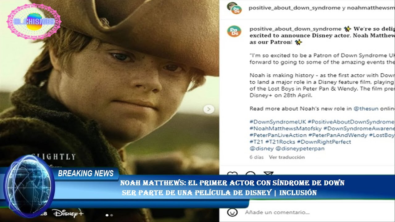 Noah Matthews: El primer actor con síndrome de Down ser parte de una ...