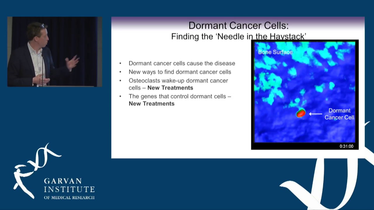 Solving the biggest mysteries: multiple myeloma and cell dormancy ...