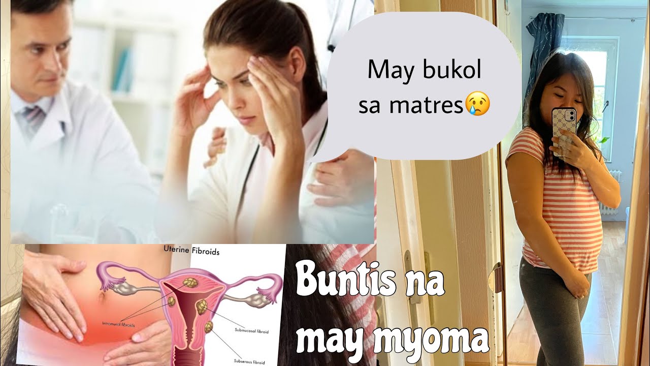 MAY NAKITANG BUKOL SA AKING UTEROS 😧 | MYOMA IN PREGNANCY🤰 | Pinay ...