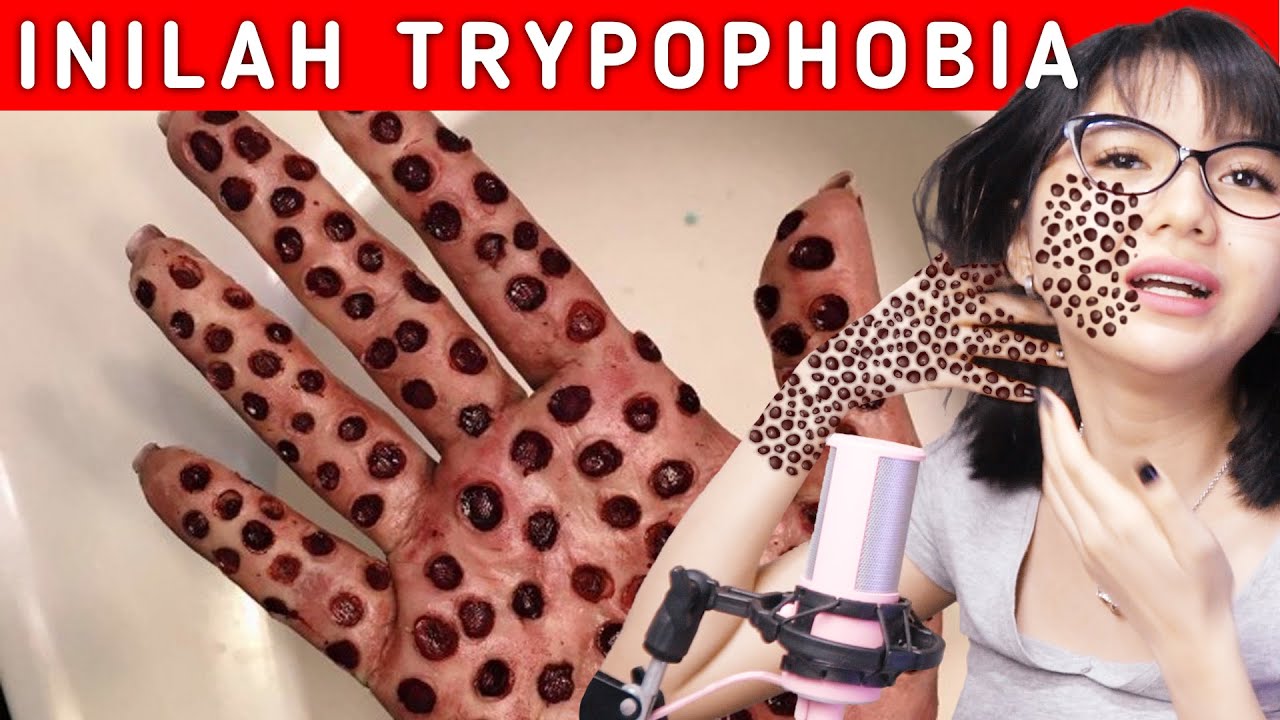 APA ITU TRYPOPHOBIA !? TERNYATA BEGINI RASANYA !! - YouTube