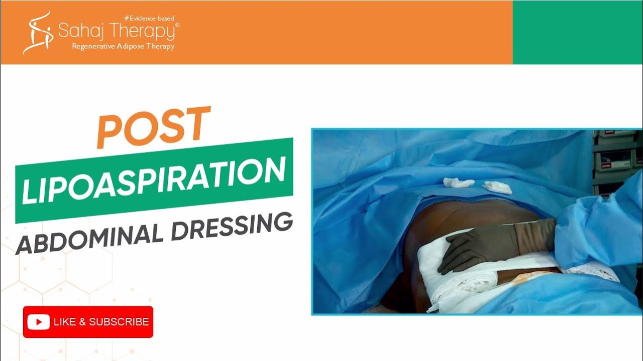Post Lipoaspiration Abdominal Dressing - YouTube