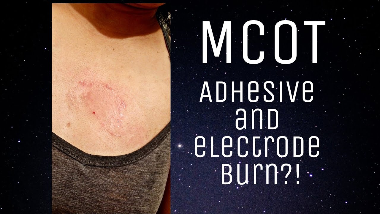 Heart Monitor Blisters - YouTube