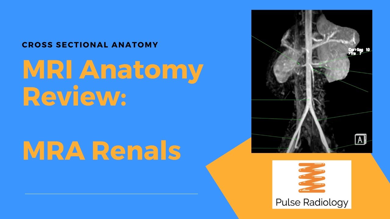 MRI Anatomy Review: MRA Renals - YouTube