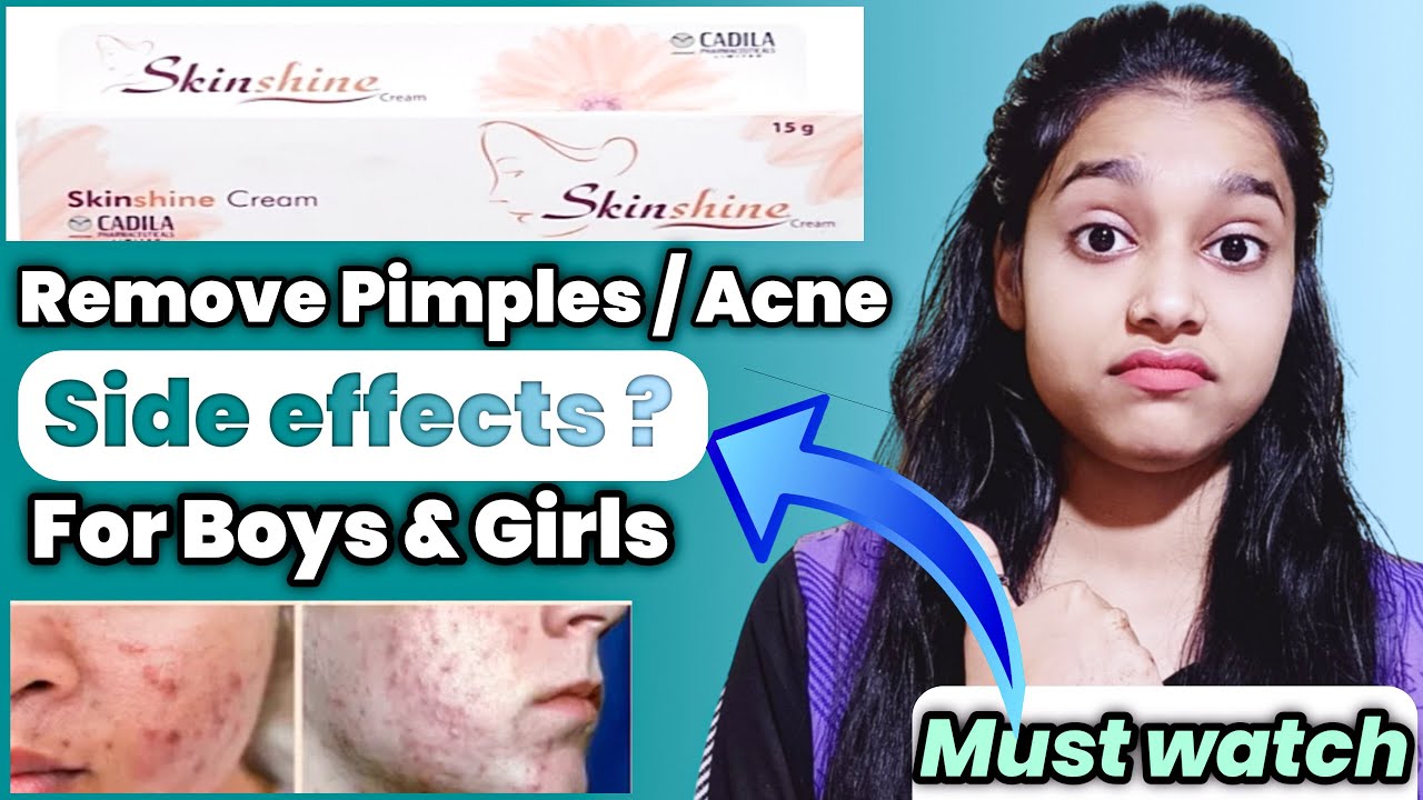 Skin shine skin whitening cream buy or not | benefits & side effects ...