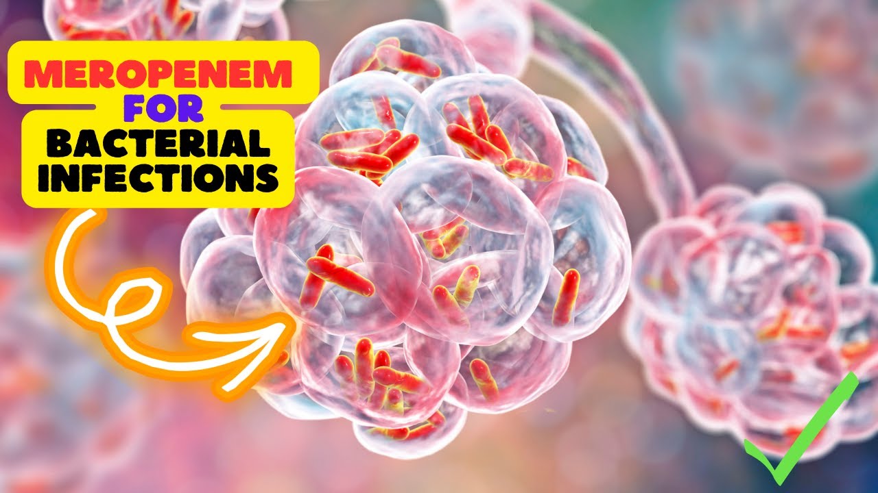 Meropenem Injection Unveiled: A Powerful Ally Against Bacterial ...