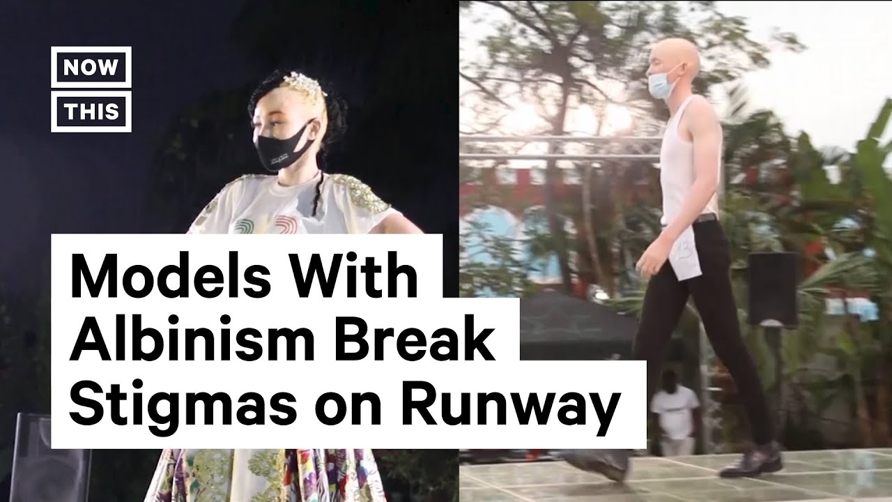 Models With Albinism Walk Runway Show in Republic of Congo - YouTube