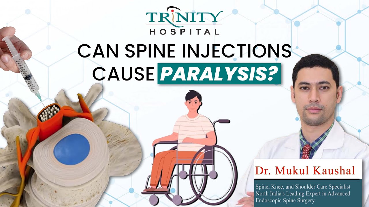 Can Spine Injections Cause Paralysis?The Truth About Epidural ...