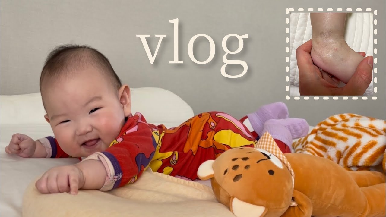 육아브이로그 6개월 아기의 하루 근데 이제 습진을 곁들인🥲치료완료 6개월 아기 발달👶🏻 장난감🧸 놀아주기 Youtube