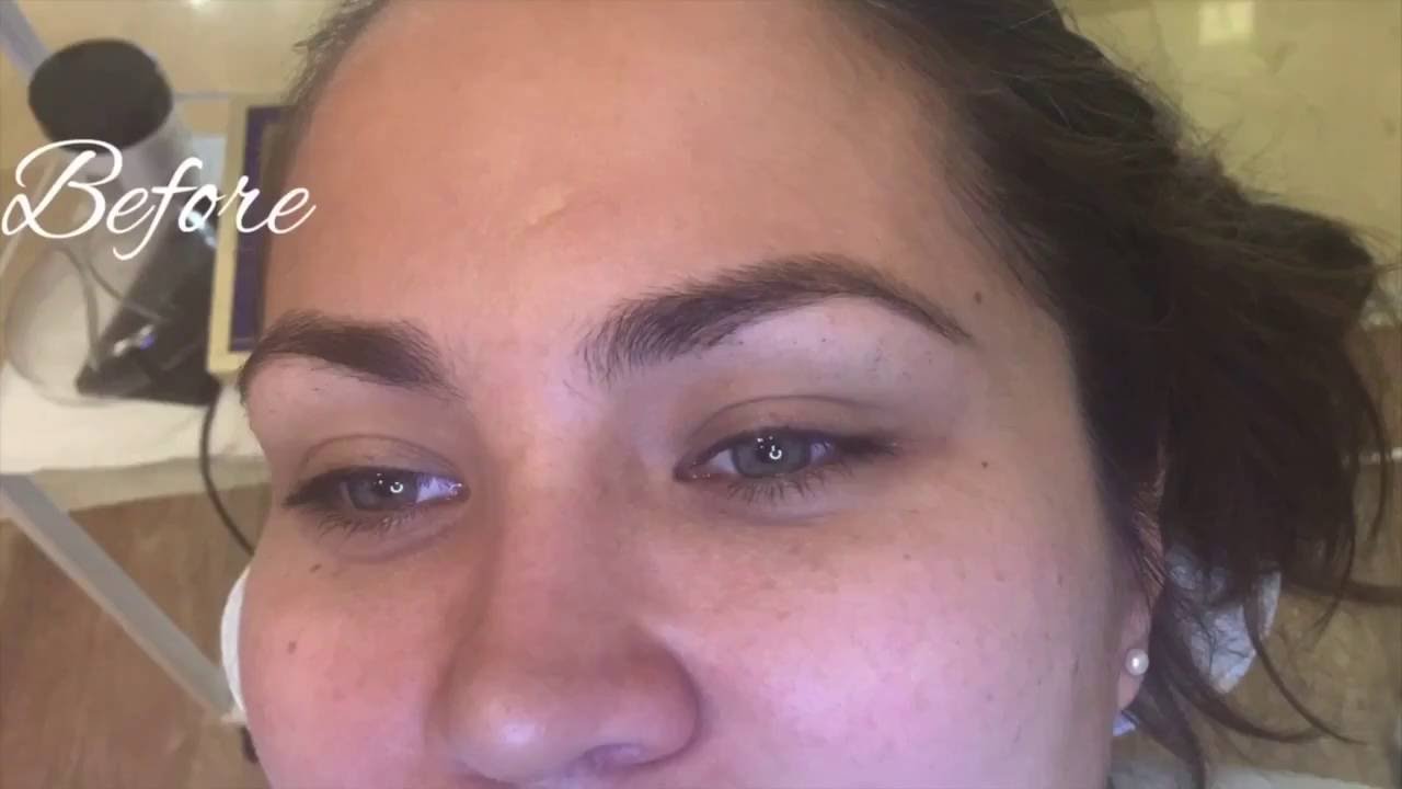 Microblading 5D by Dr. Eyebrows - YouTube
