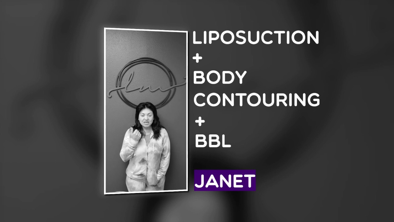 Vaser Liposuction + Body Contouring + BBL Testimonial - YouTube