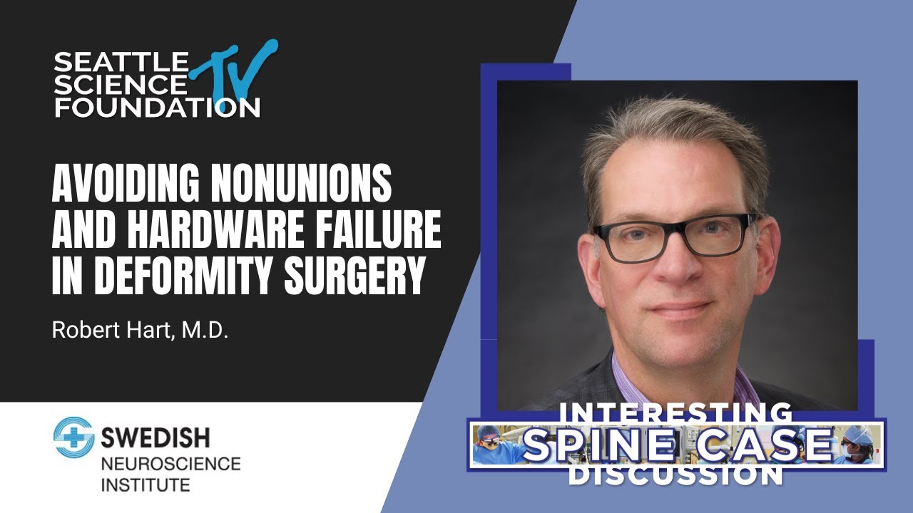 Avoiding Nonunions and Hardware Failure in Deformity Surgery - Robert ...