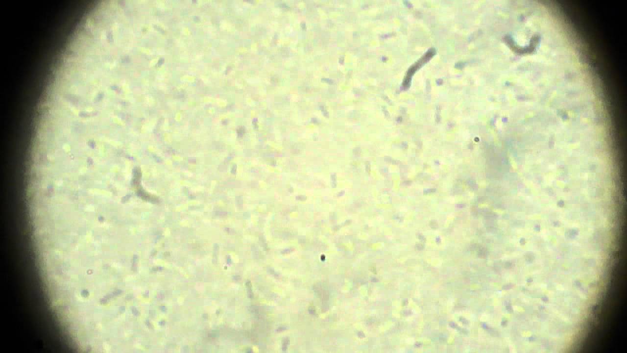 Microbial movement - YouTube