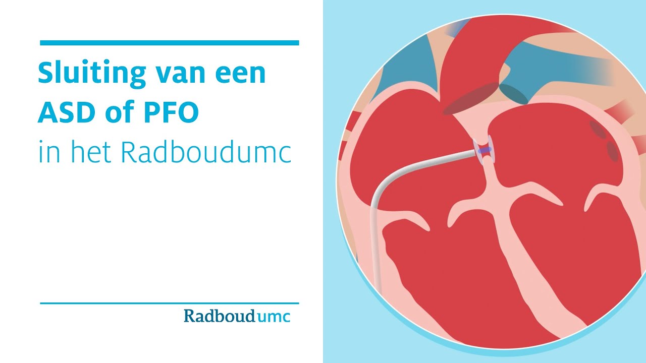 ASD of PFO - YouTube