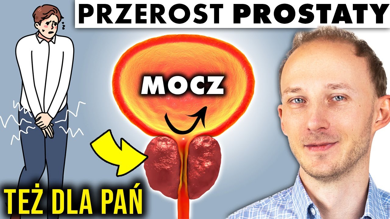 10 metod na przerost prostaty! Prostata: objawy rozrostu | Dr Bartek ...