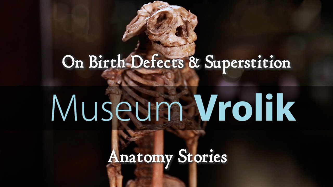 Museum Vrolik - Anatomy Stories 4: On Birth Defects & Superstition ...