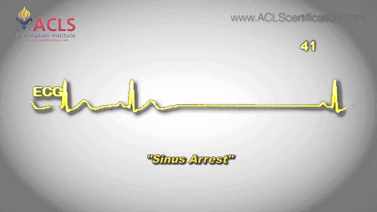 Sinus Arrest by ACLS Certification Institute - YouTube