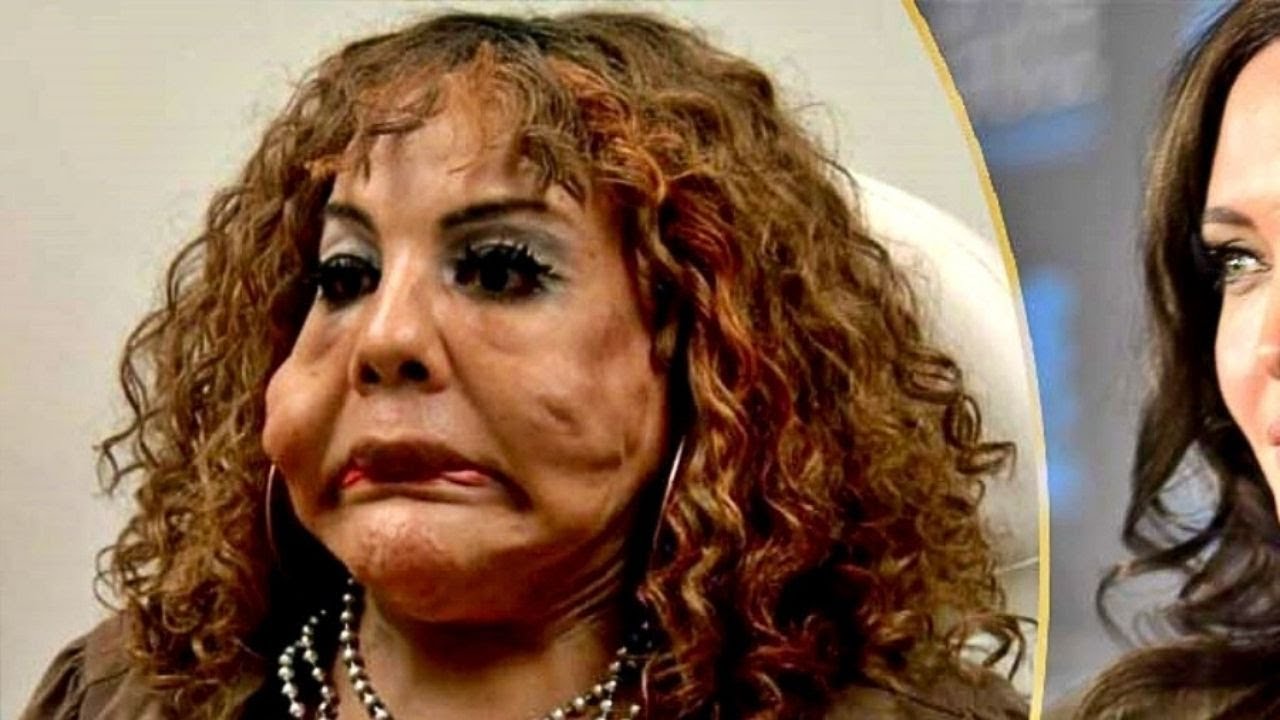 They Were So Beautiful Before; Now Look At Them; #10 Will Shock You ...