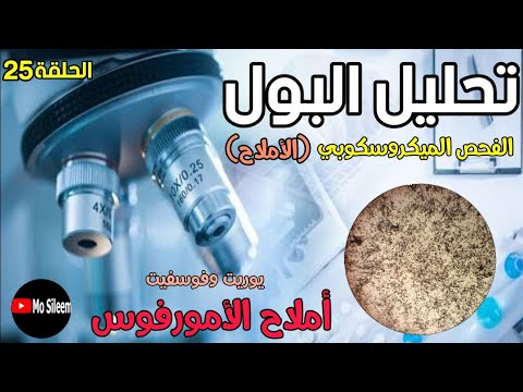Urinalysis 25 microscopic ex Amorphous (Urate & Phosphate) - YouTube