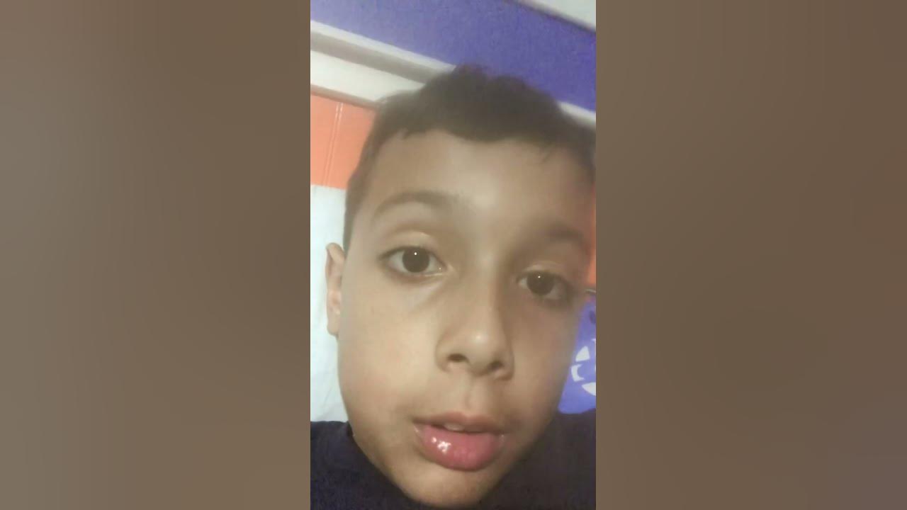 I Broke My Arm Youtube