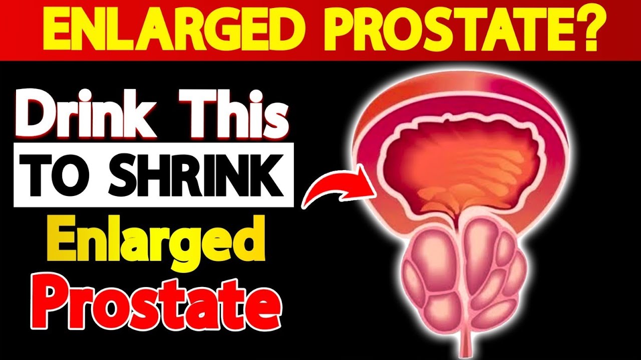 Prostate Patients! 3 Drinks You Should Take & 3 Drinks You Should Never ...