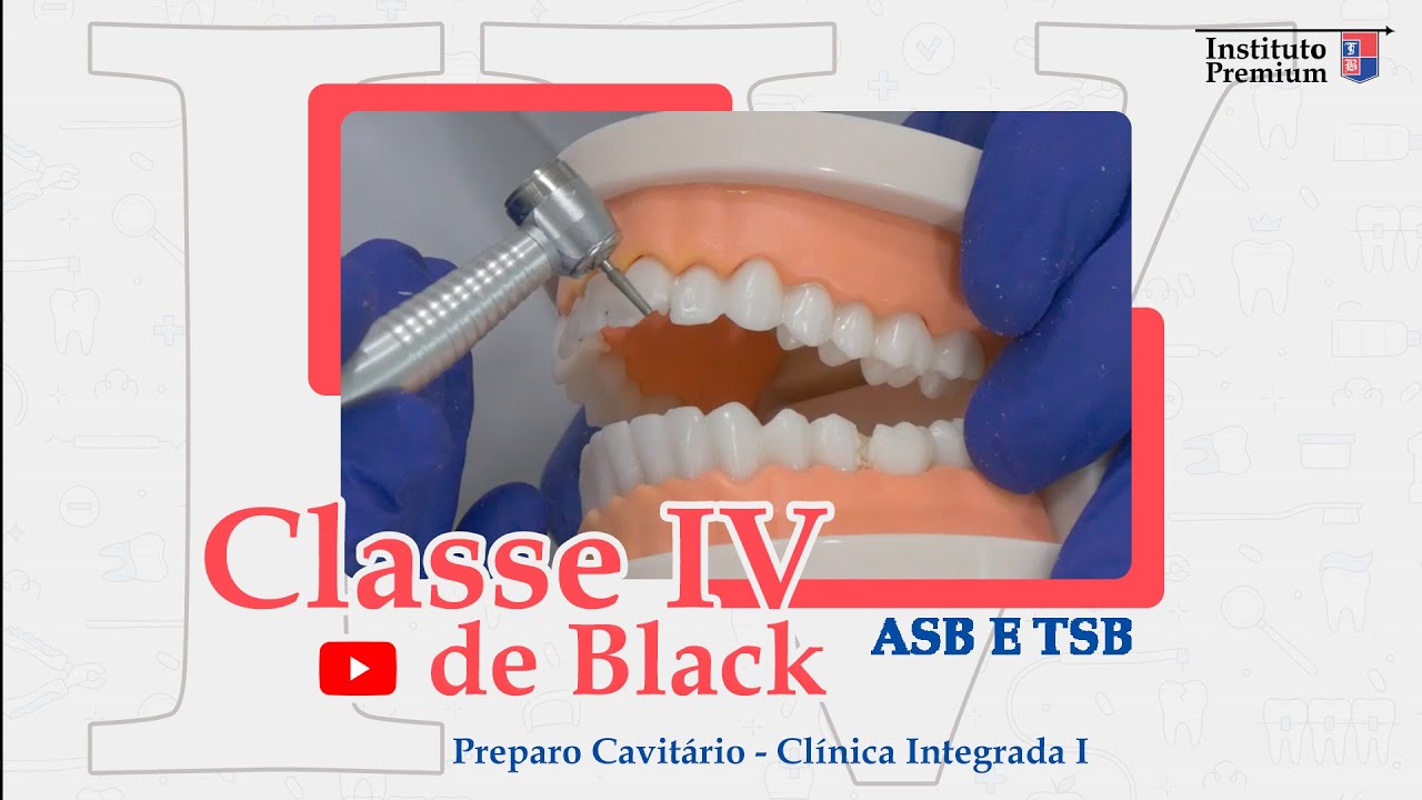 PREPARO CAVITÁRIO #4 - Instituto Premium 🦷 - YouTube