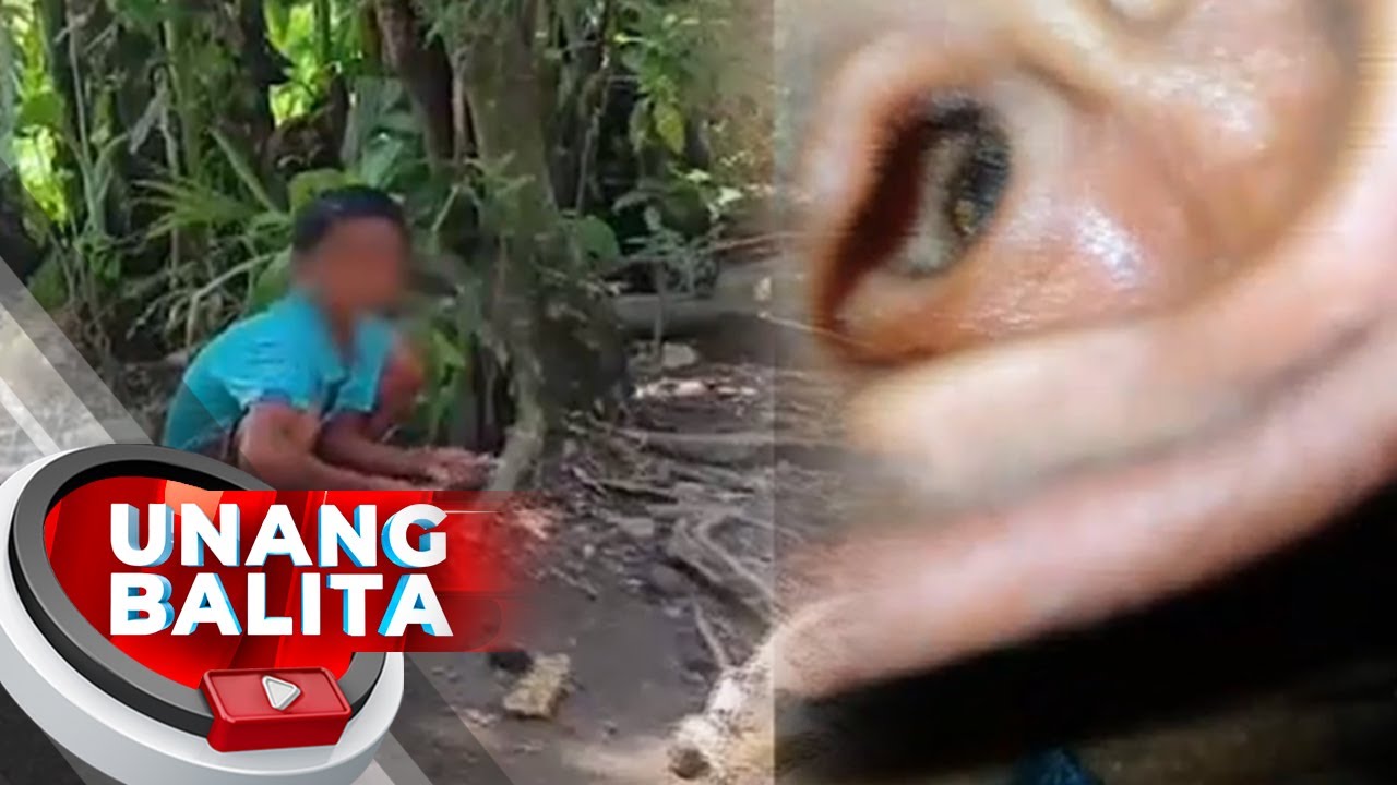 Uod, nakita sa loob ng tenga ng bata | UB - YouTube