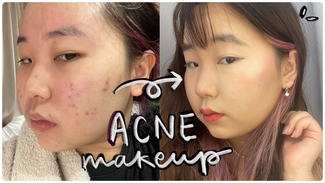 mask-proof makeup tutorial to cover acne (without colour corrector ...
