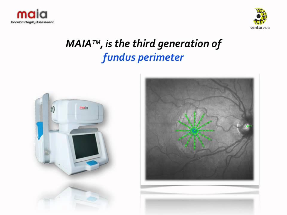 MAIA Macular Integrity Assessment - YouTube
