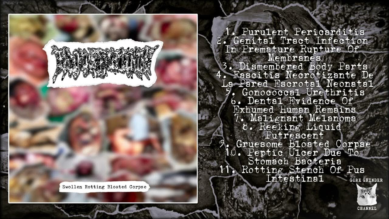 Benzoylmethylecgonine - Swollen Rotting Bloated Corpse (Compilation) - YouTube