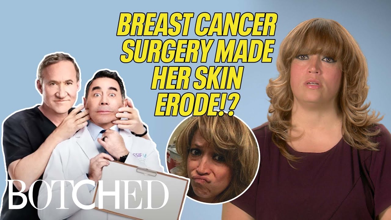 Ann Marie's Skin ERODED After Breast Cancer Removal?! (Before & After ...