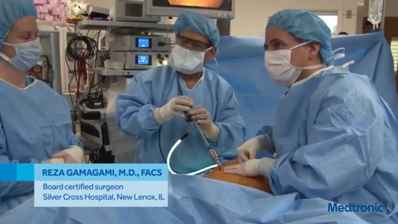 Procedure Video for ProGrip™ Laparoscopic Self-Fixating Mesh - YouTube