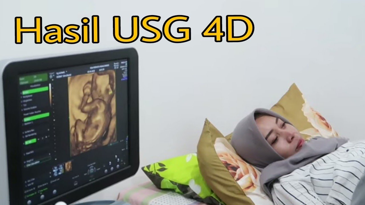HASIL USG 4D USIA KEH4MILAN 17 MINGGU ‼️ DOKTERNYA LUCU - YouTube