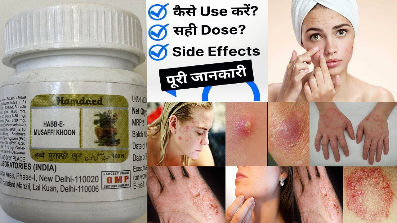 Habb-E-Musaffi Khoon Uses, Side Effects | Treat boils, scabies, acne ...