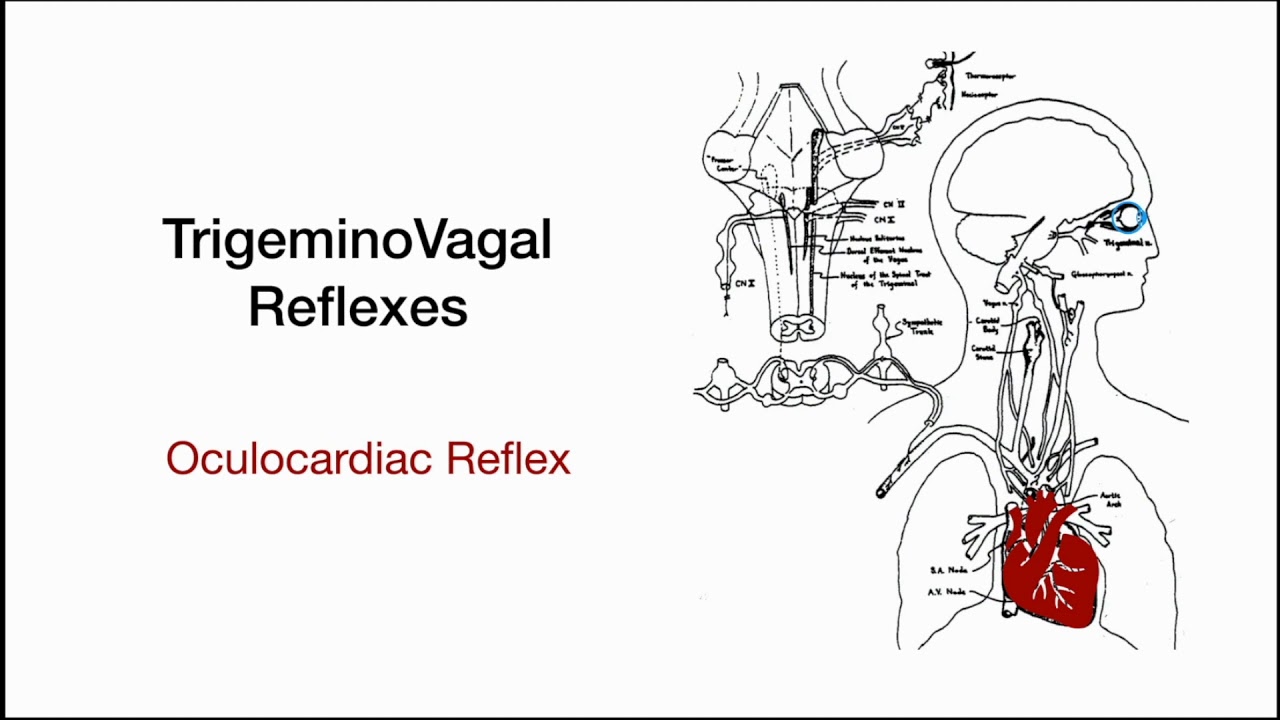 Oculocardiac Reflex During Rop Exams - Video abstract [ID 288043] - YouTube