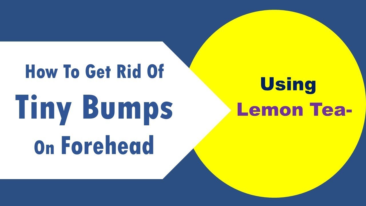how to get rid of tiny bumps on forehead using Lemon Tea - YouTube