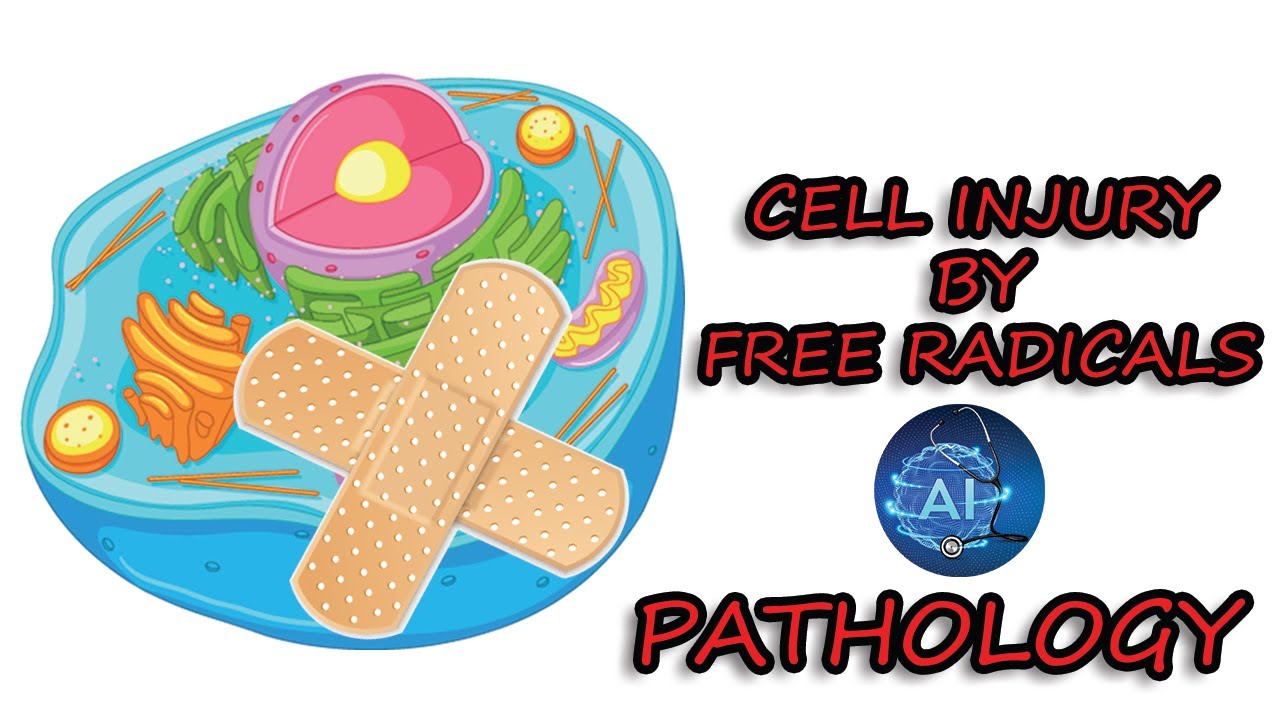 Cell Injury by Free Radicals | Production of Free Radicals | General ...
