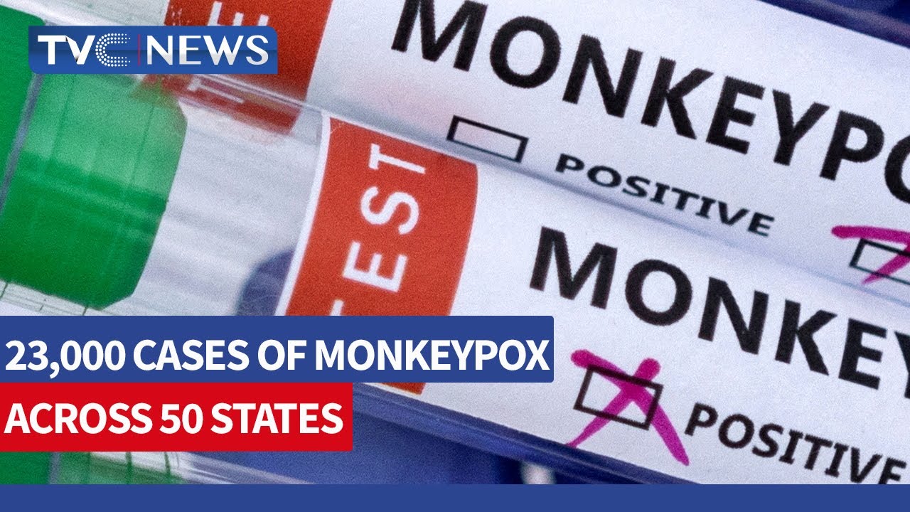 US Records 23,000 Cases of Monkeypox Across Its 50 States, Washington ...