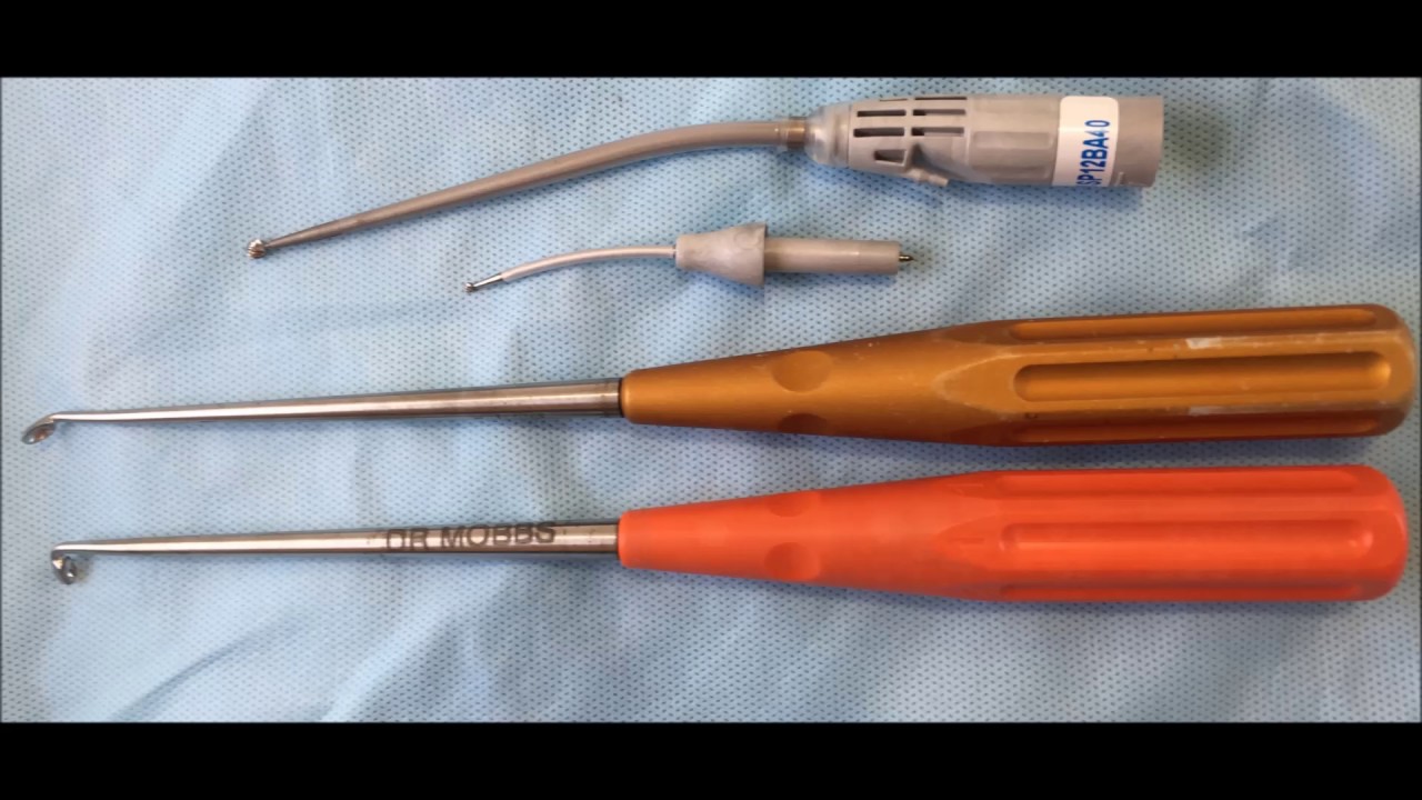 ULBD Unilateral Laminectomy for Bilateral Decompression - YouTube