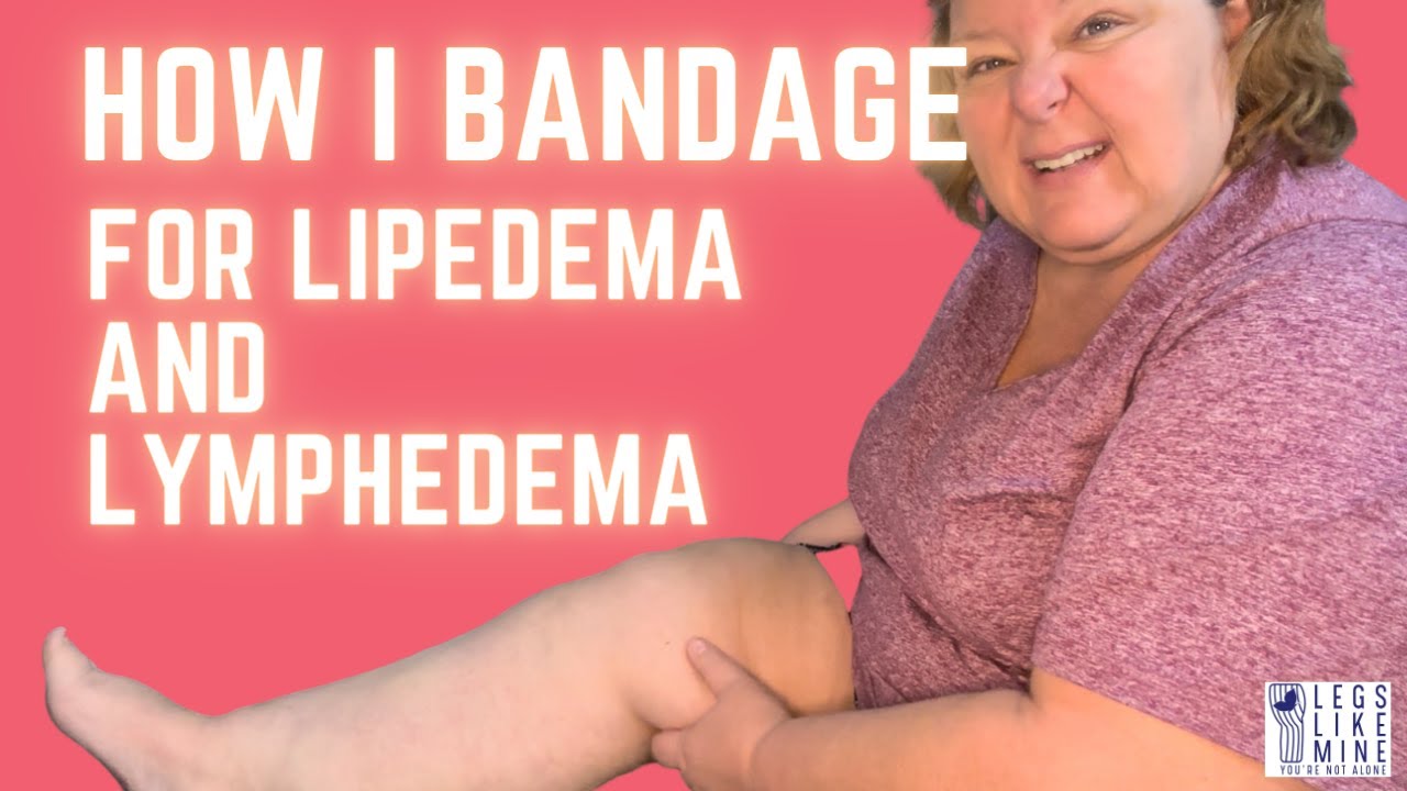 Unveiling My Leg Bandaging Routine: Mastering Lymphedema And Lipedema ...